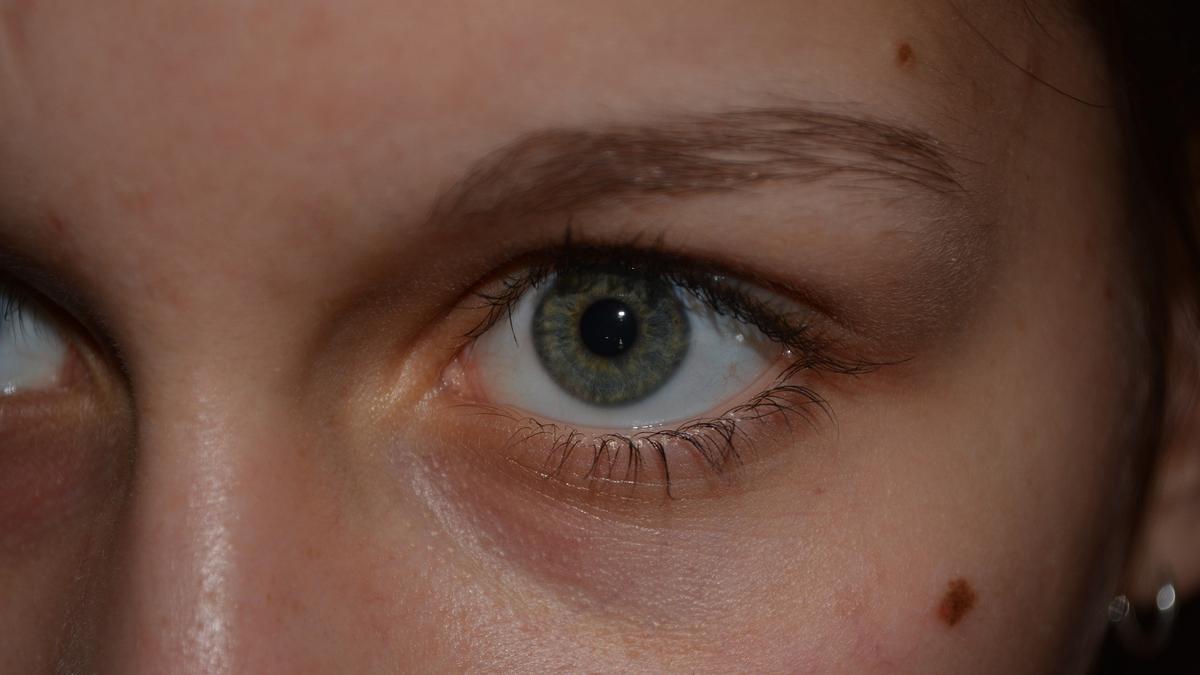 Kepribadian Wanita Berdasarkan Letak Tanda Lahir, di Dahi Artinya Apa?