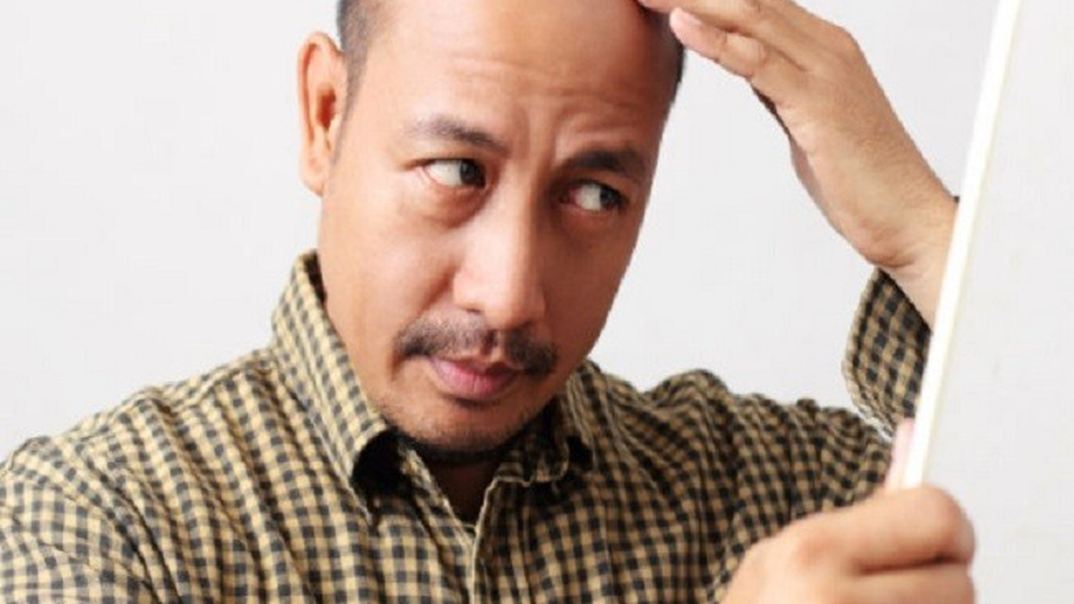 5 Fakta tentang Kebotakan pada Pria - Fashion & Beauty Liputan6.com