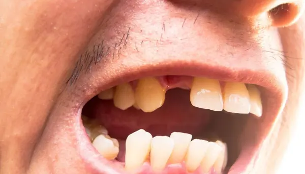 Apa Itu ODF: Panduan Lengkap Tentang Open Document Format - Feeds ...