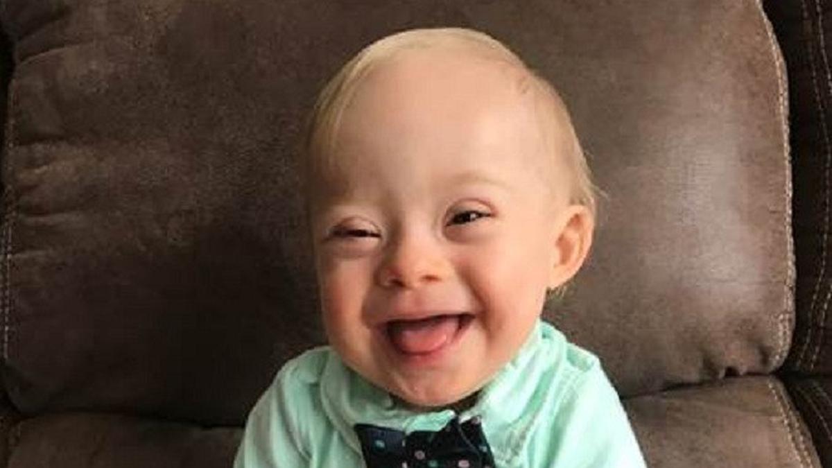 Senyum Ceria Bayi Down Syndrome Pemenang Kontes Baby Gerber 2018