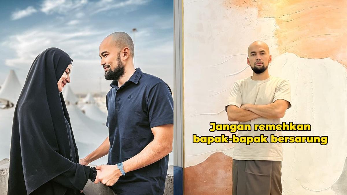 Tampil Botak dan Makin Humoris, Ini 7 Potret Terbaru Teuku Wisnu - Hot ...