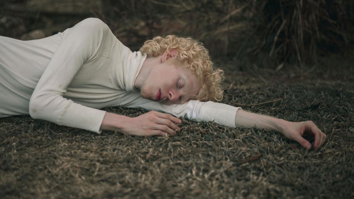 Albino Adalah Kelainan Genetik Kekurangan Pigmen Melanin, Kenali ...