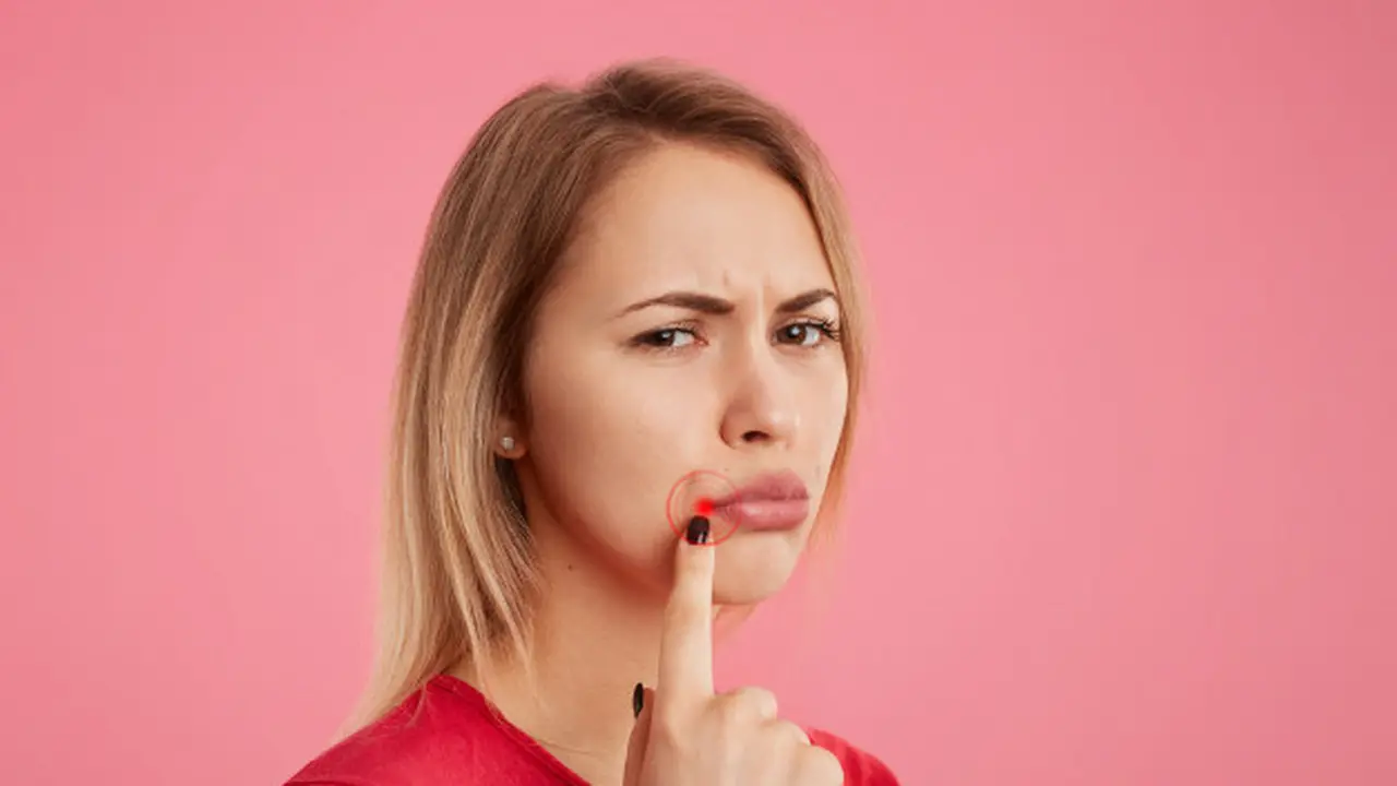 Penyebab Bintik Putih yang Tiba-tiba Muncul di Bibir Serta Cara ...