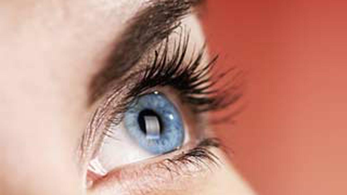 Operasi Laser Ubah Warna Mata - Health Liputan6.com