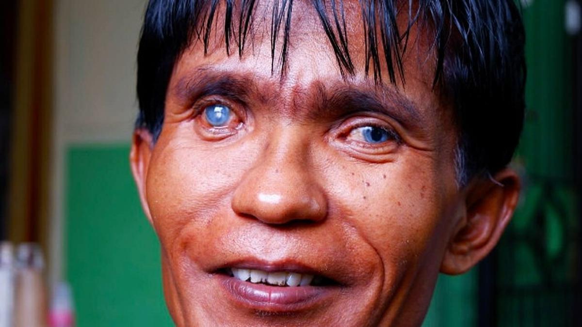 Kisah Keluarga Bermata Biru dari Tanah Datar Sumbar