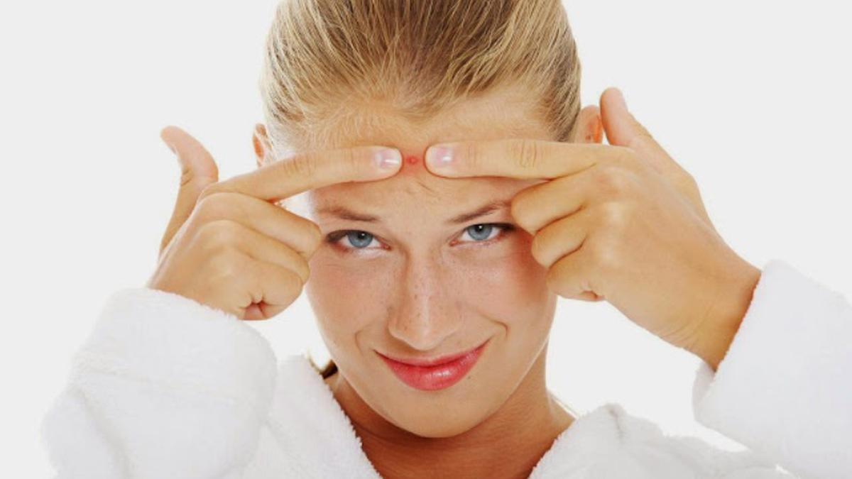 Jangan Panik Dulu Jika Punya Jerawat di Dahi - Health Liputan6.com