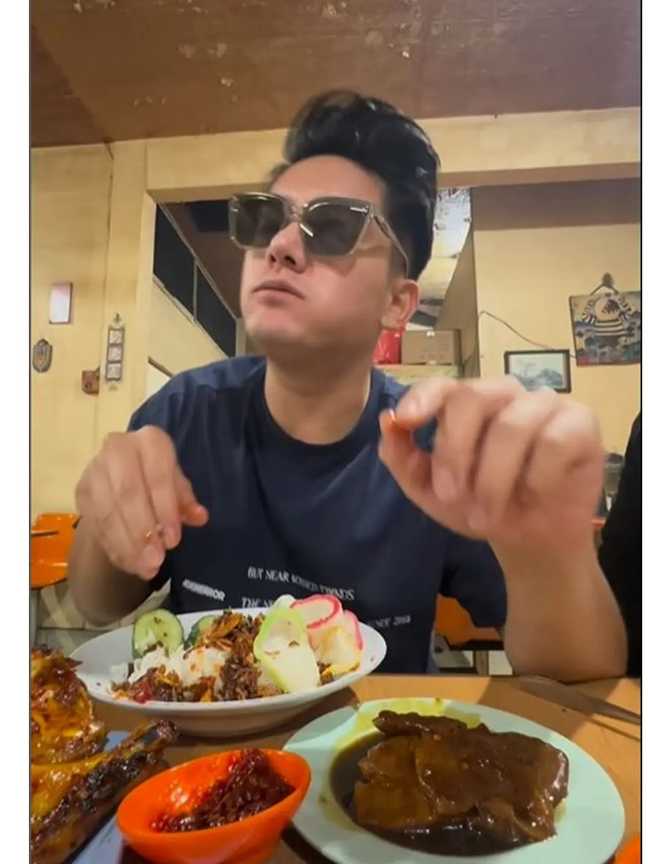 6 Potret Boy William Usai Oplas Hidung di Korea, Telan Biaya Rp1,1 ...