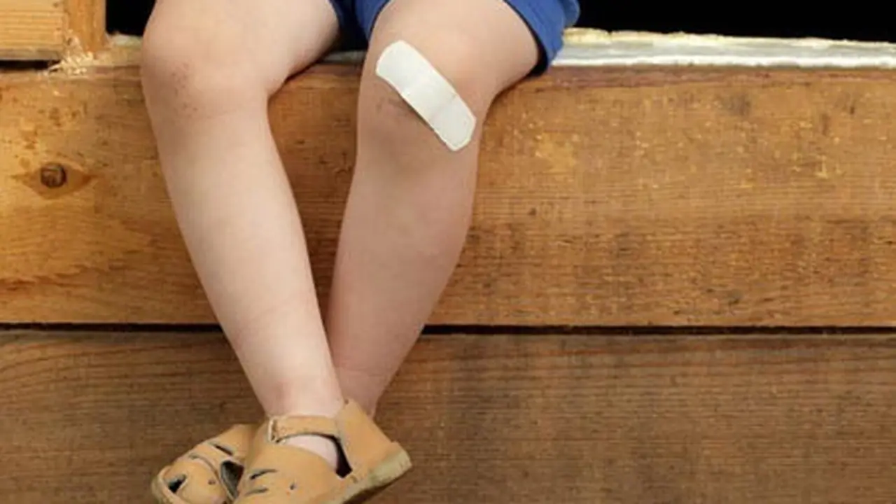 Luka Lecet Terlihat Ringan tapi Bisa Infeksi, Ini Cara Mengobatinya ...