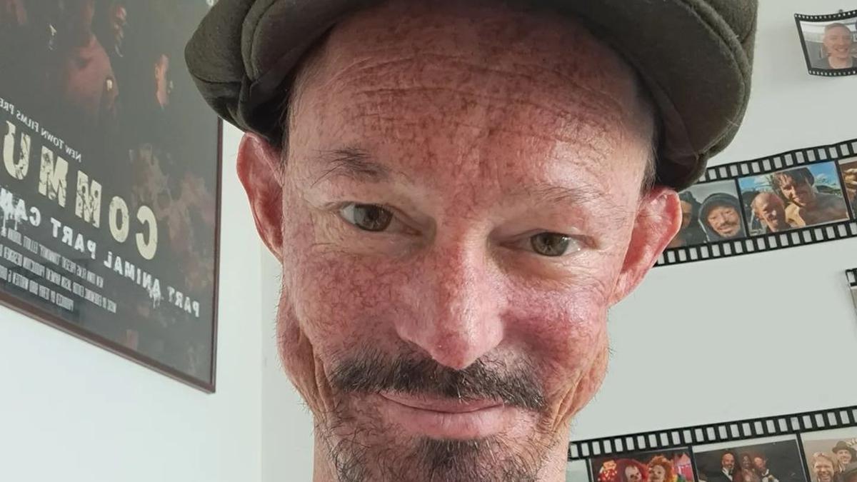 Aktor Game of Thrones Darren Kent Meninggal Dunia dalam Usia 36 Tahun ...