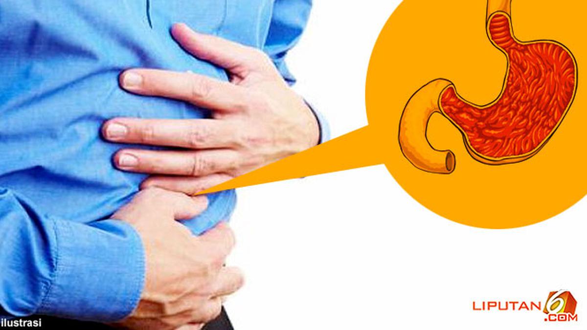 Mengenal Maag dari Gejalanya - Health Liputan6.com