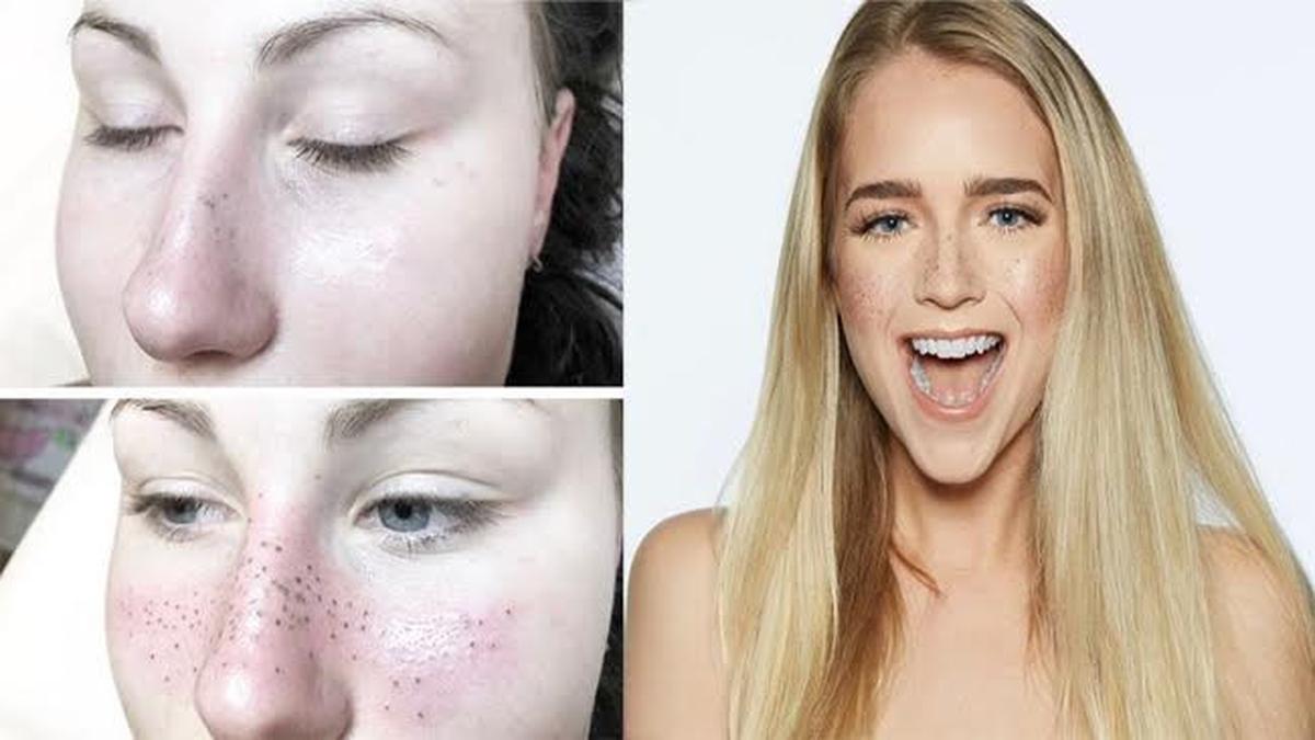 Tato Bintik Hitam di Wajah Jadi Tren Kecantikan Baru - Citizen6 ...