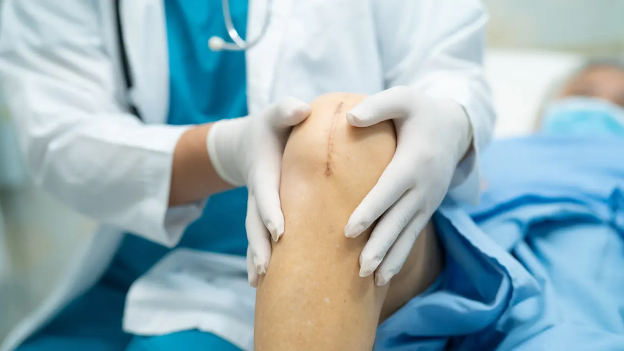 Bagaimana Perawatan Pra dan Pasca Operasi Total Knee Replacement? Ini ...