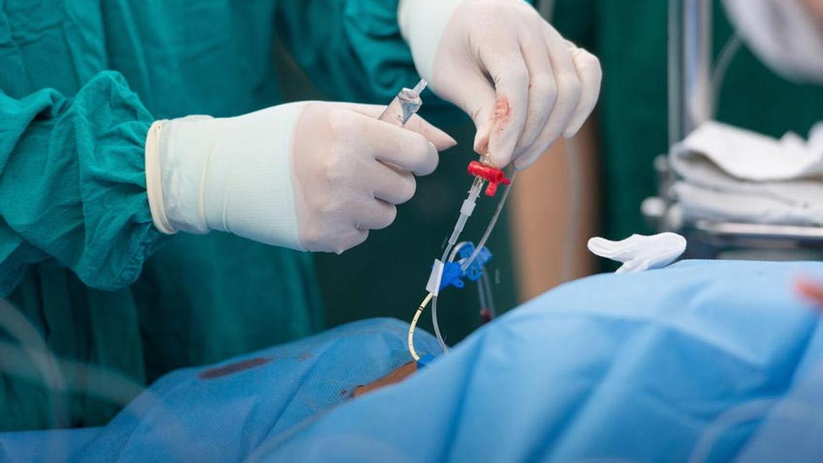 Kateter adalah Alat Medis Berupa Tabung Kecil yang Dimasukan ke Tubuh ...