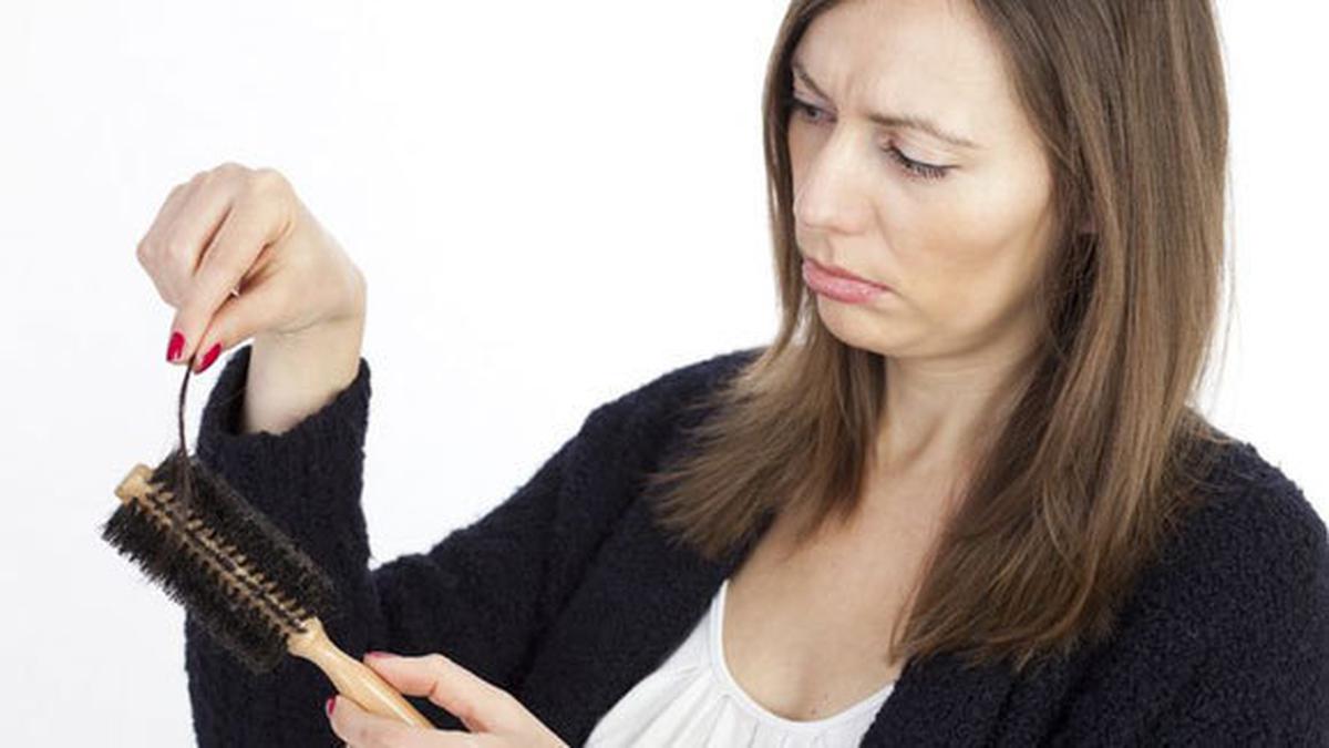 Ketahui Sebab Sebelum Temukan Cara Mengatasi Rambut Rontok (Bagian 7 ...