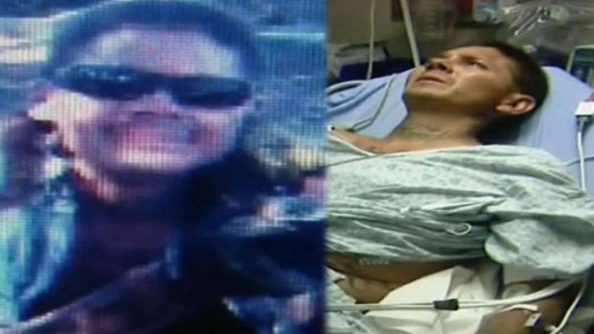 Nekat Selfie Bareng Ular Liar, Tangan Pria Ini Diamputasi - Tekno ...