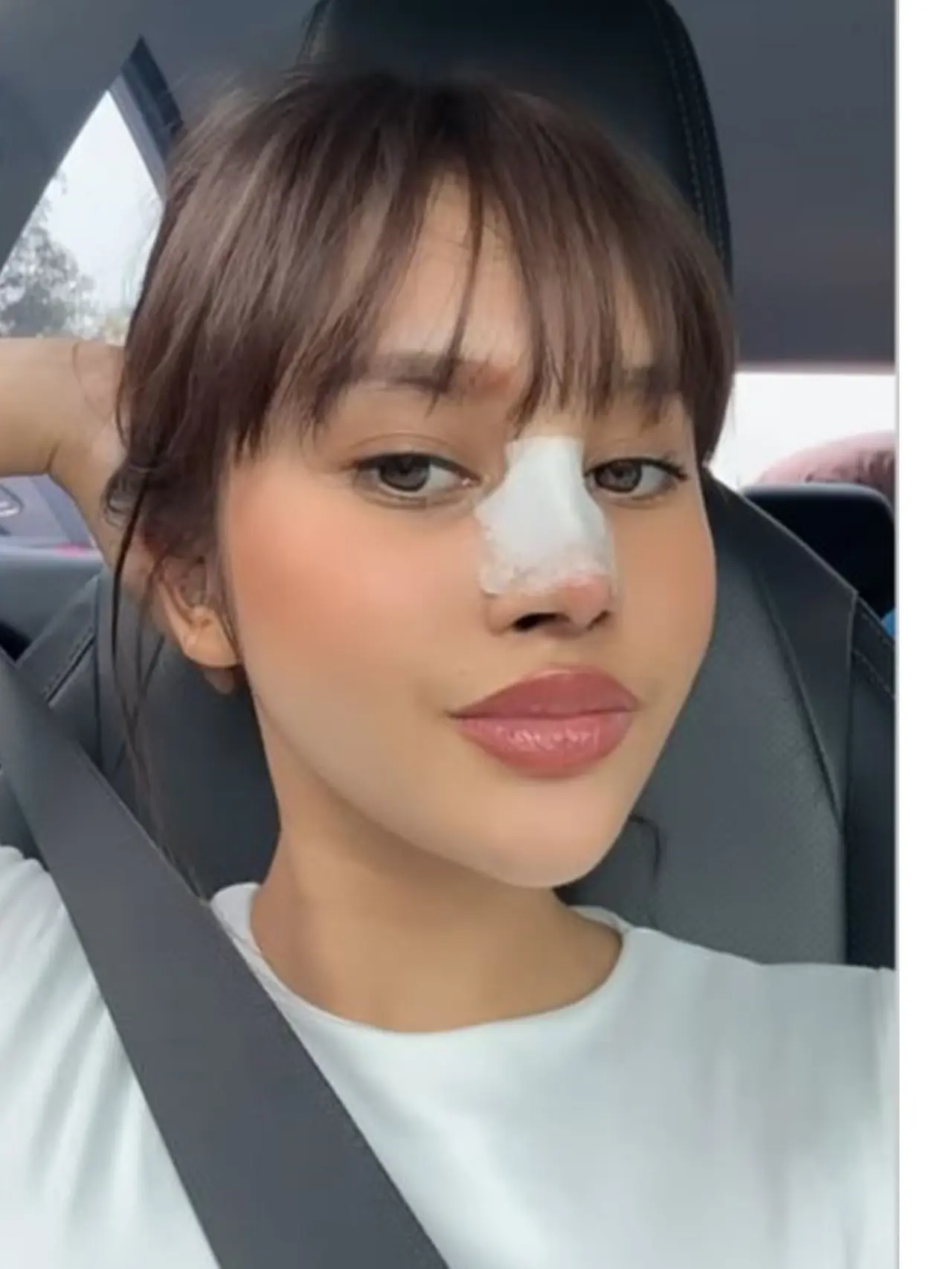 6 Potret Permesta Dhyaz Anak Farida Nurhan Oplas Hidung Lagi, Dulu ...