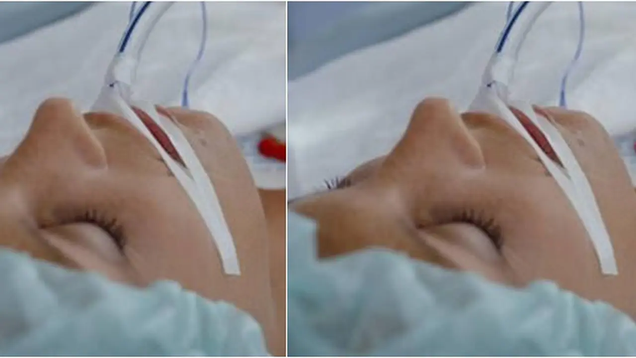 5 Orang Dengan Pengalaman Menakjubkan Seputar Koma - Lifestyle Fimela.com