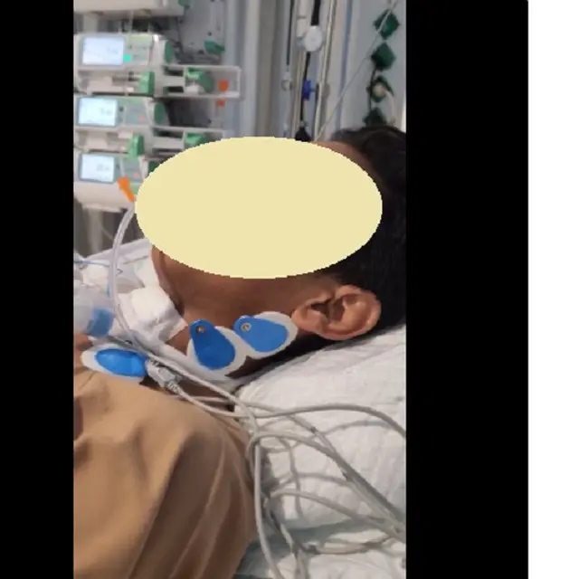 Jonathan Latumahina Perlihatkan Rekaman Wajah David Pakai Selang dan ...