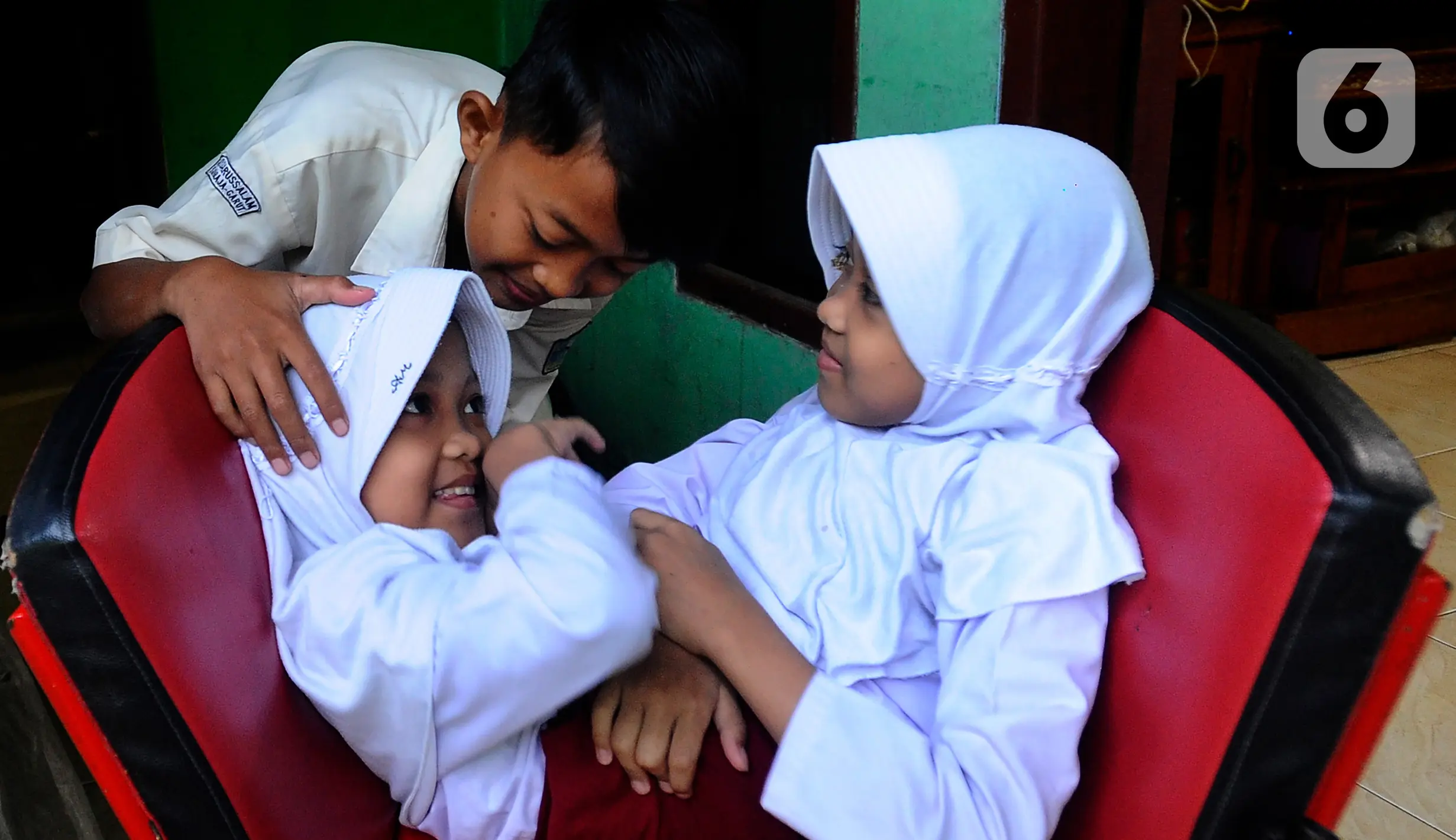 Potret Semangat Kembar Siam Al Dewi dan Al Putri Asal Garut - Foto Liputan6.com