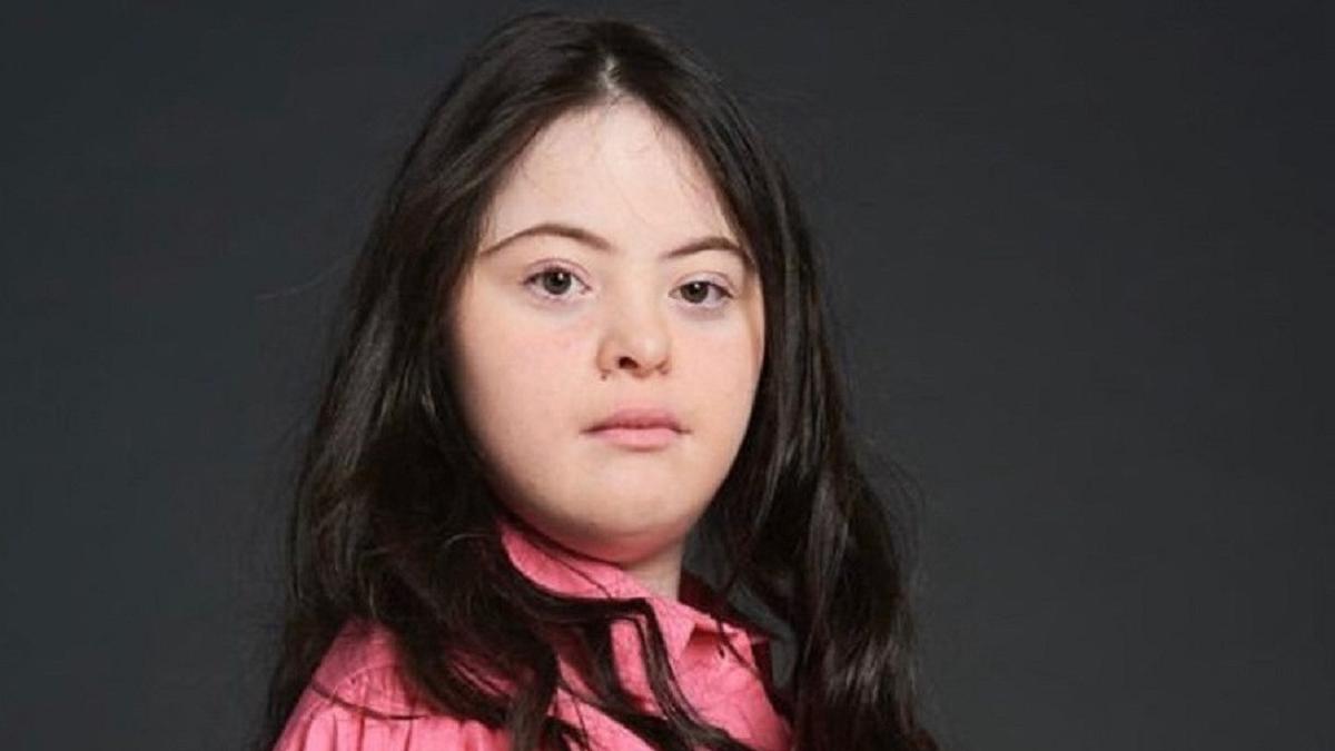 Mengenal Down Syndrome Dan Ciri Cirinya Disabilitas