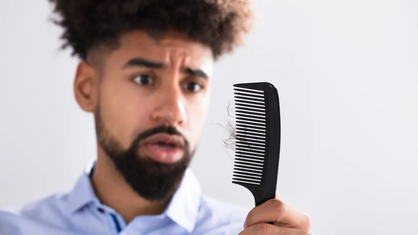 Rambut Rontok Pada Pria, Ini Penyebab dan Cara Mengatasinya yang Tepat