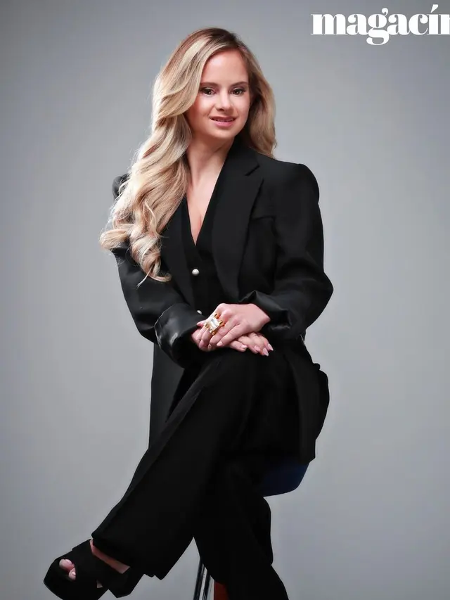 6 Potret Sofia Jirau Model Down Syndrome Pertama Victorias Secret