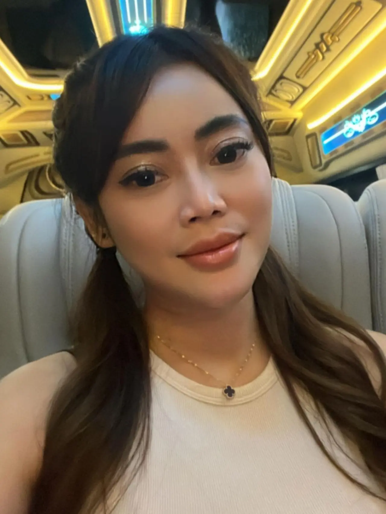 6 Potret Daniar MasterChef Usai Operasi Hidung, Jadi Sorotan - Hot Liputan6.com