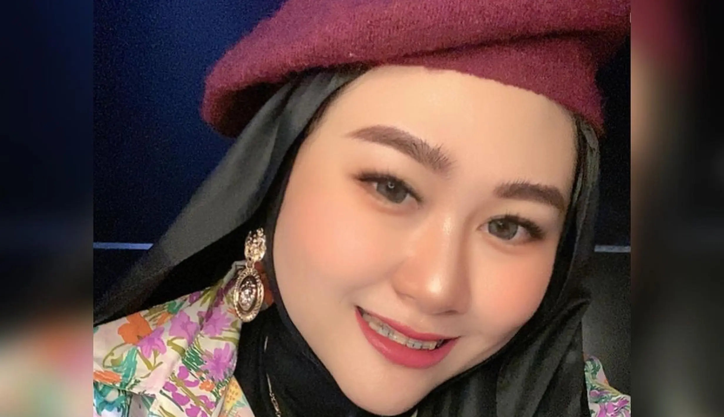 Potret Close Up Shelvie Hana Wijaya, Istri Daus Mini yang Gugat Cerai Sang Suami - Foto Liputan6.com