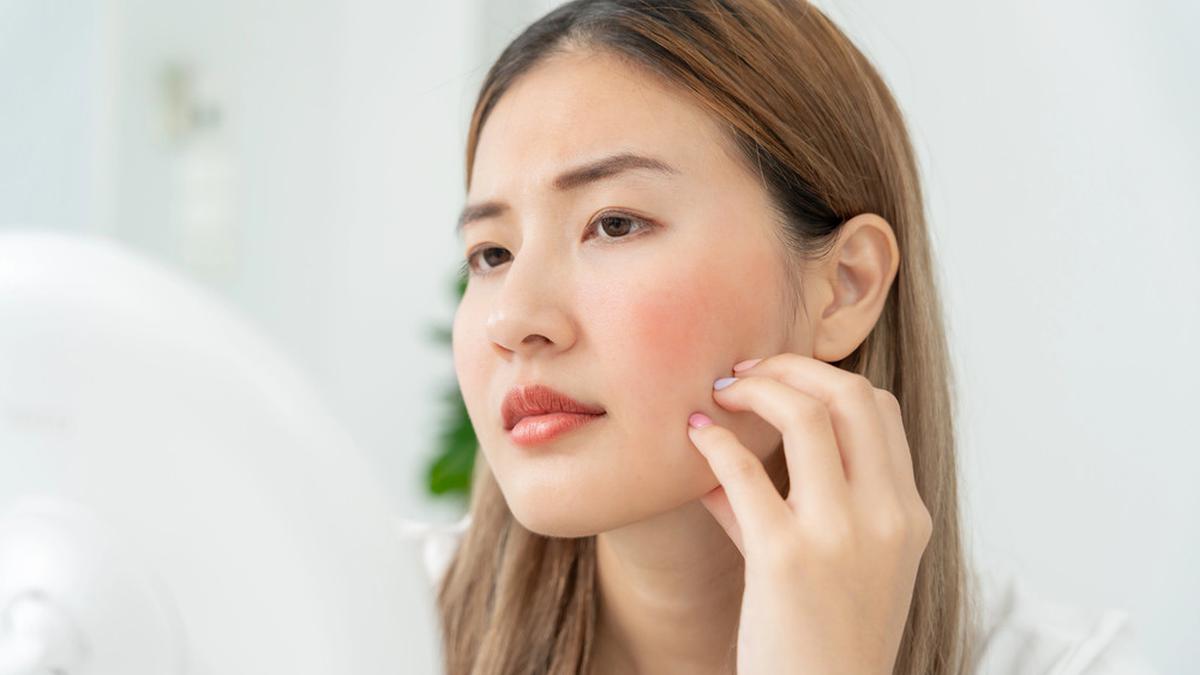 How To: Menenangkan Kulit Wajah Kemerahan Menurut Anjuran Ahli ...