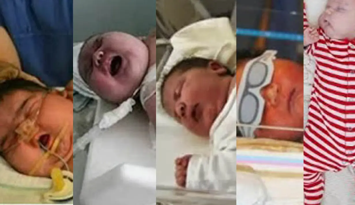 Ini 7 Bayi Raksasa di Berbagai Penjuru Dunia - Foto Liputan6.com