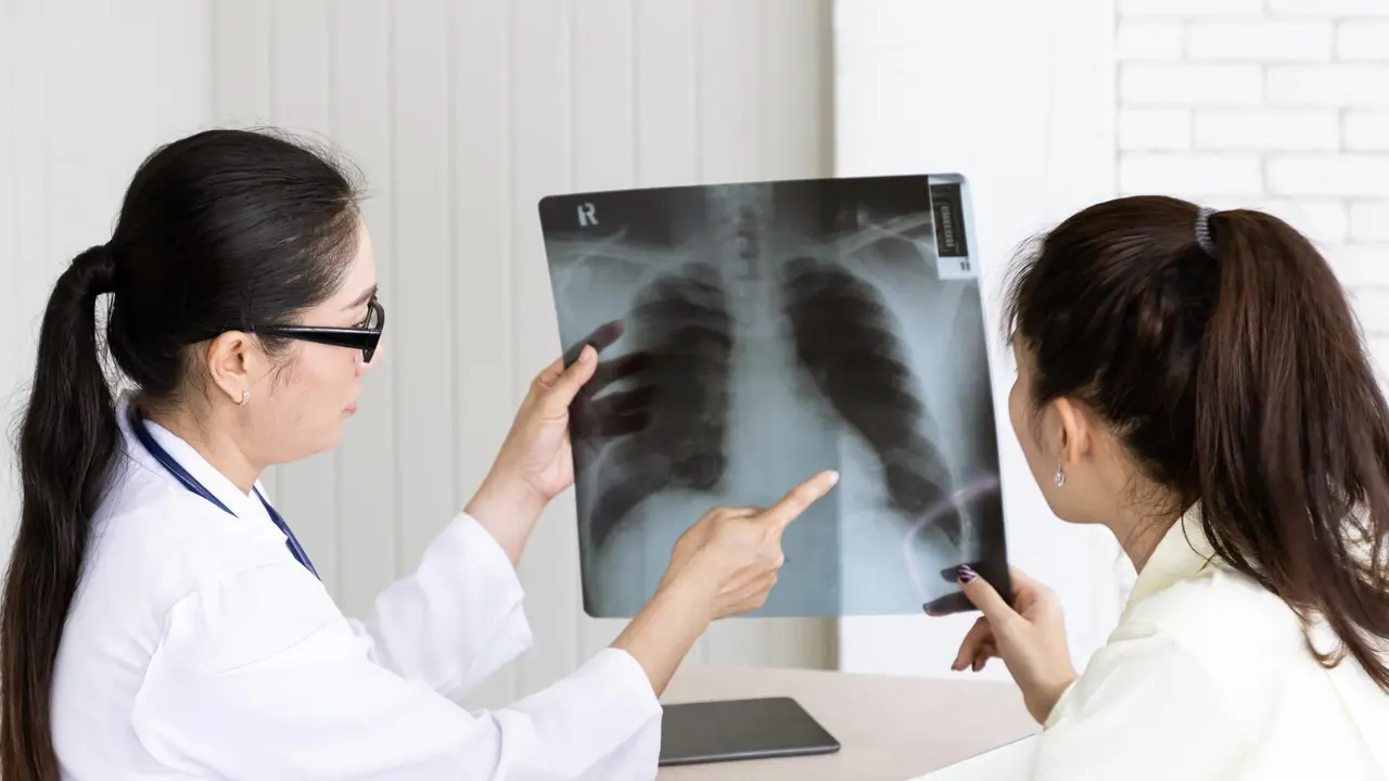 Jangan Anggap Remeh! Kenali Apa Itu TBC, Gejala, dan Cara Penanganannya ...