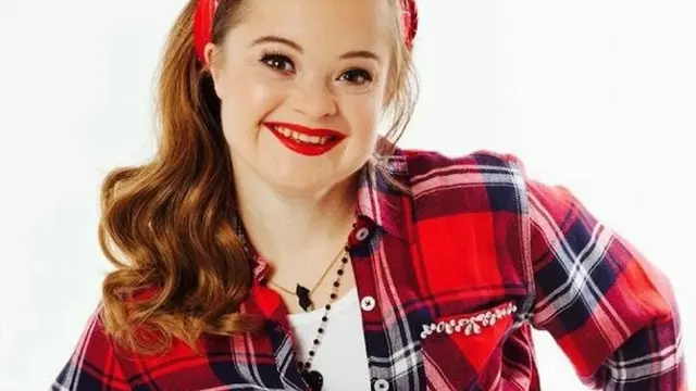 Katie Meade, Difabel Down Sydrome yang Jadi Model Produk Kecantikan ...