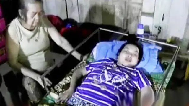 VIDEO: Rodiyah, Manusia Kayu yang Lebih Parah dari Sulami - TV Liputan6.com