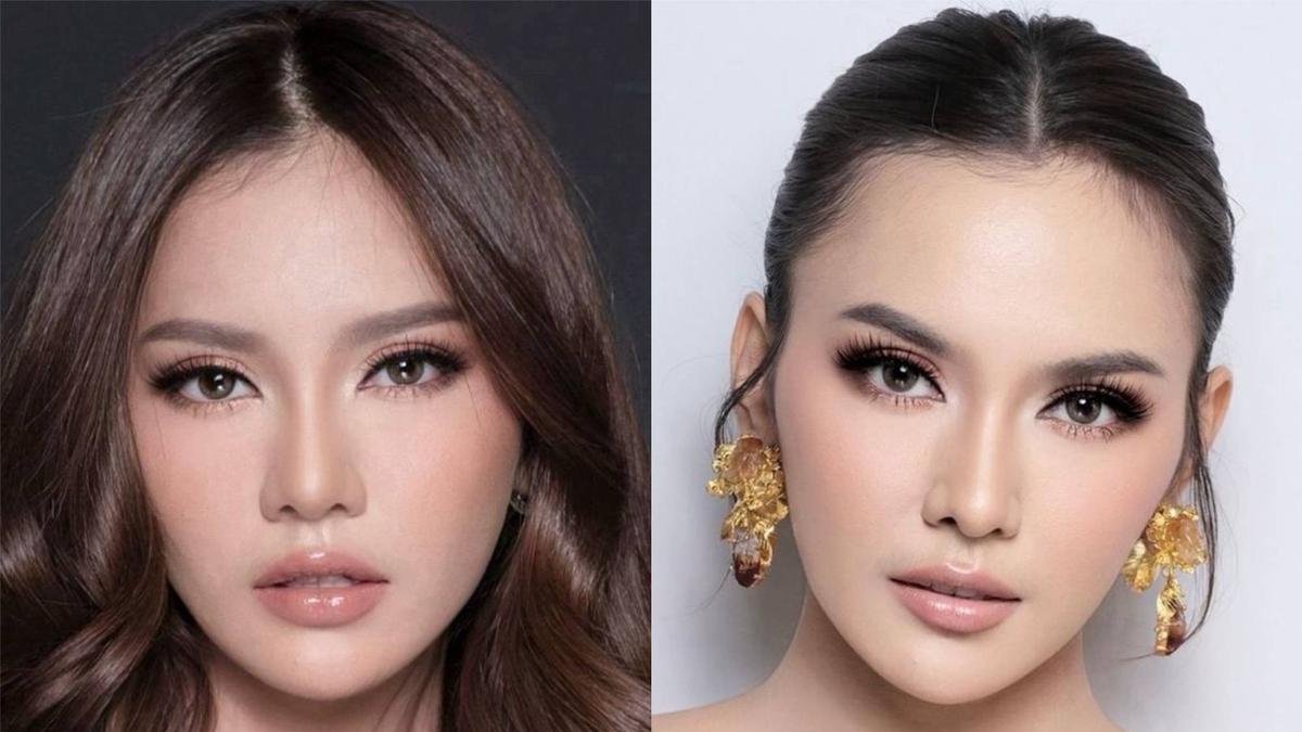 Setelah Penampilannya Pasca Operasi Ramai Dibicarakan, 9 Potret Pesona ...