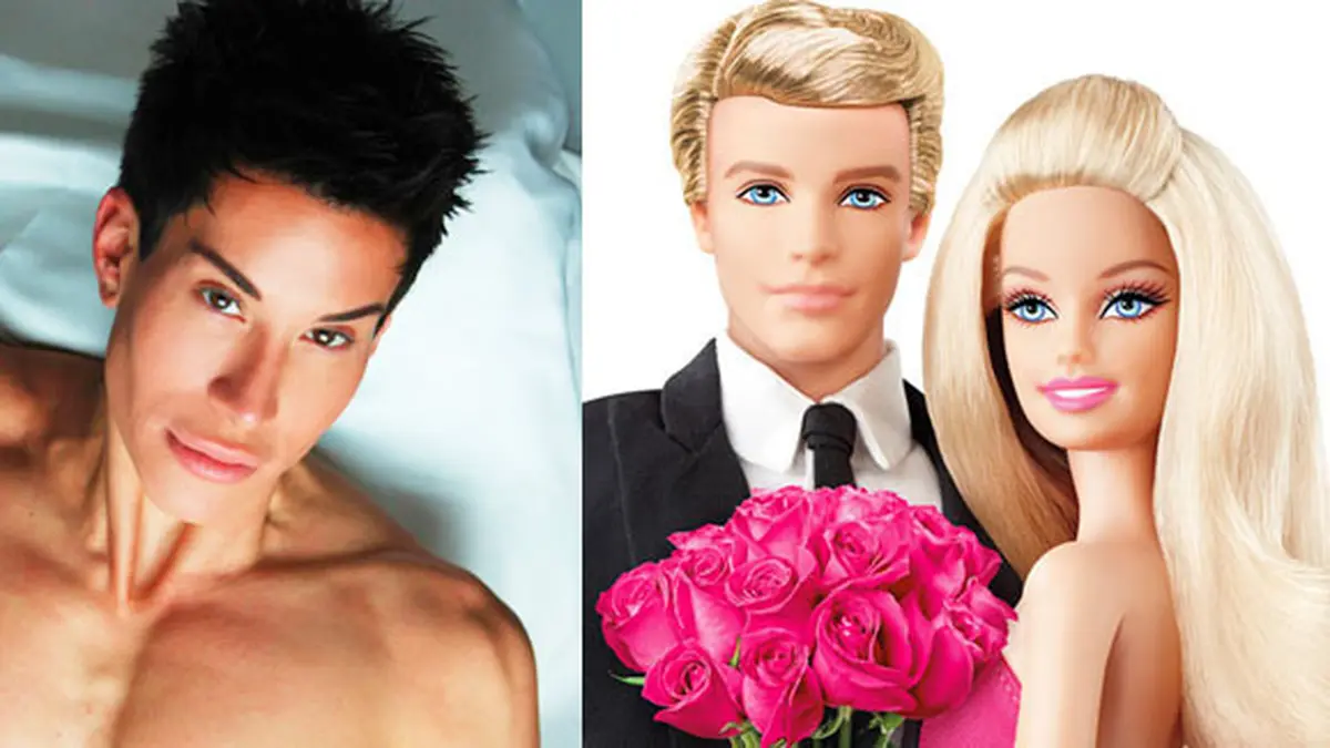 Foto Manusia Barbie Sebelum Operasi