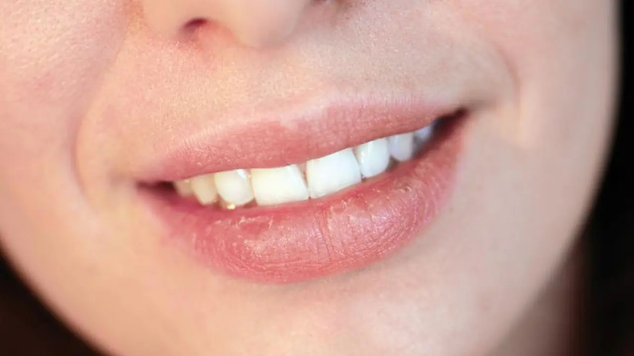 Sebelum Makin Parah, Ini Cara Setop Kebiasaan Menggigit dan Menjilat ...