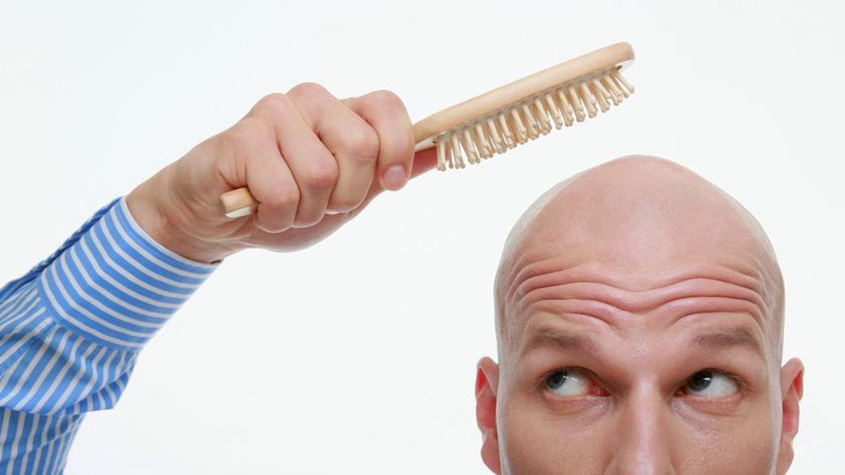 Ahli: Pria Botak Lebih Percaya Diri dan Cerdas Ketimbang yang Berambut ...