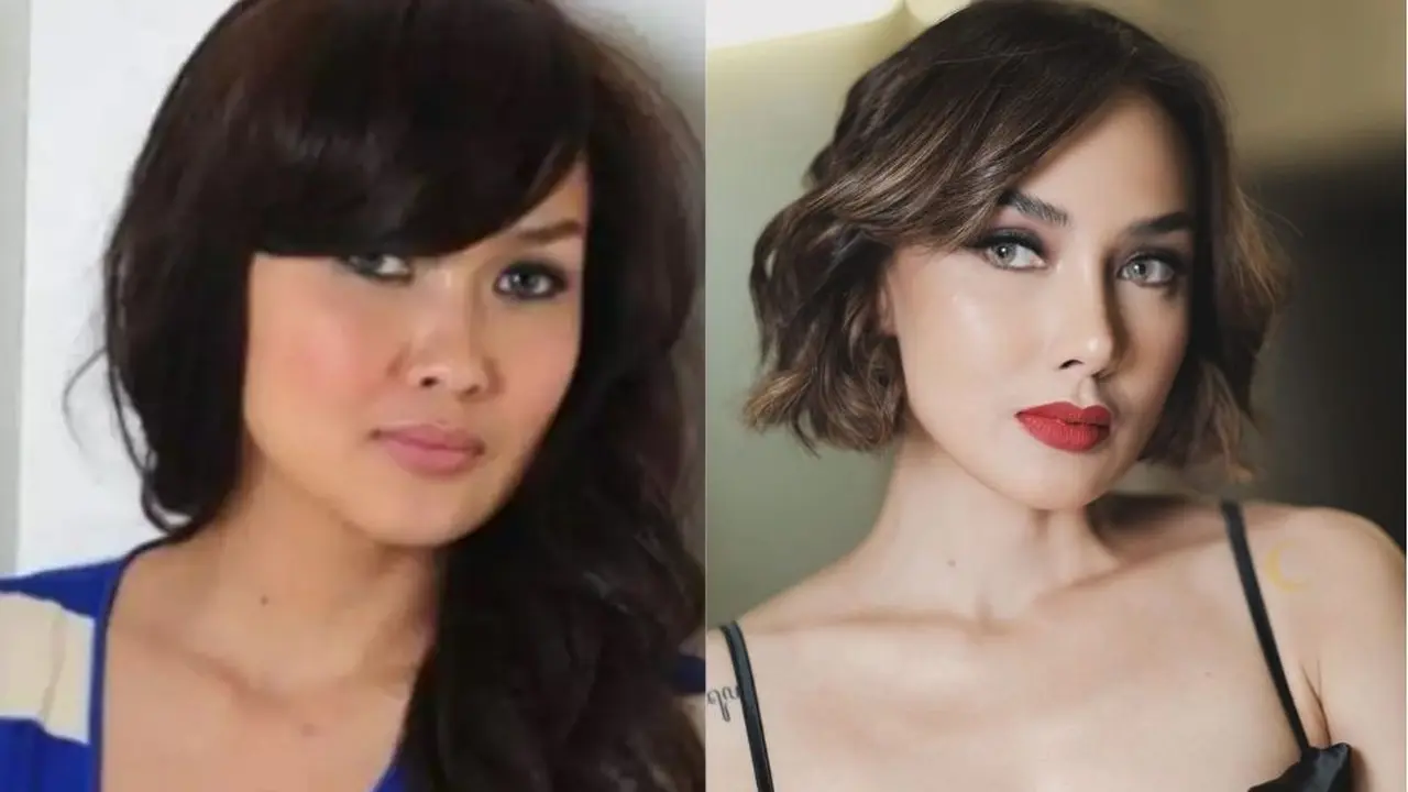 Filler Bibir Berujung Ketagihan? Intip 10 Transformasi Artis Ini ...