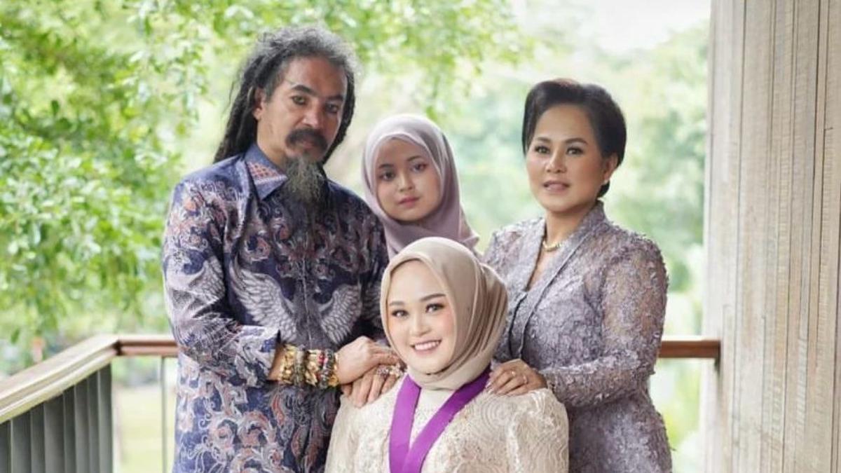 Foto-foto Cecillia Gina Anak Limbad, Calon Dokter Gigi yang Tengah ...