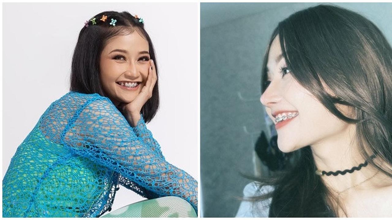 6 Potret Riyuka Bunga Sebelum dan Sesudah Oplas Hidung, Dulu Dipanggil ...