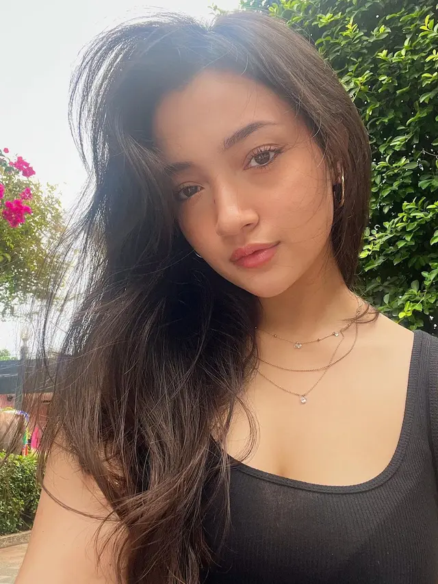 7 Potret Megan Domani Pamer Wajah Berjerawat, Sempat Takut Bertemu Orang Lain - Hot Liputan6.com