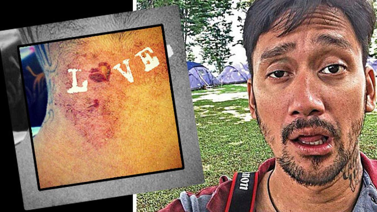 Busyet! Tora Sudiro Digigit Tomcat, Bekasnya Berbentuk Hati - ShowBiz ...