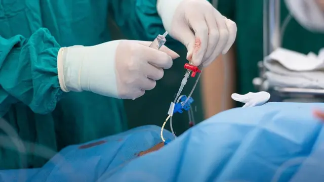 Kateter adalah Alat Medis Berupa Tabung Kecil yang Dimasukan ke Tubuh ...