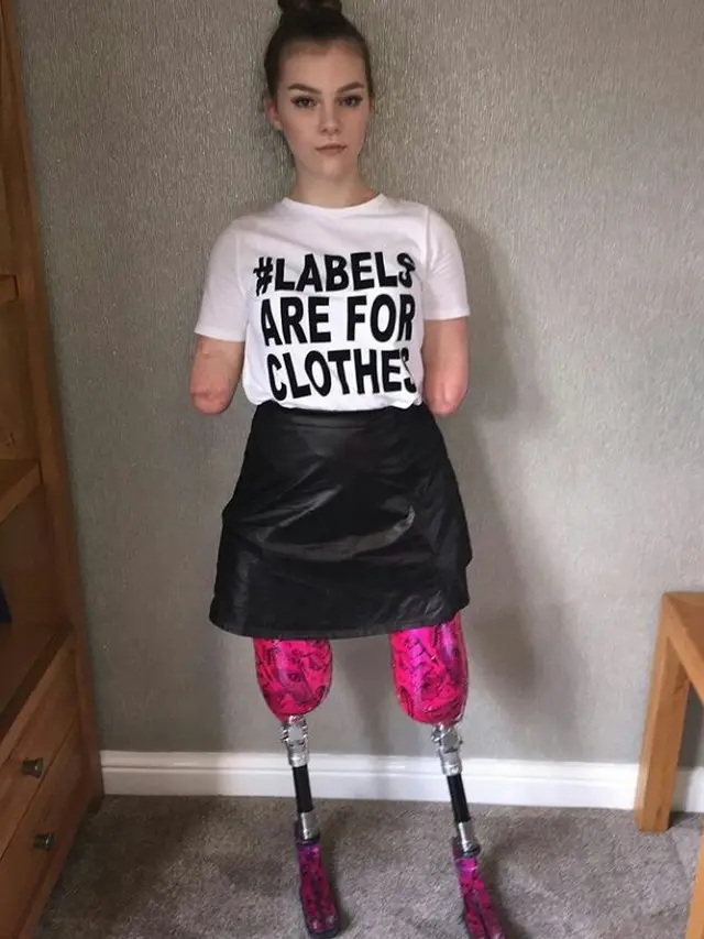 Jadi Atlet Senam hingga Pebalap Motor Tanpa Kaki-Tangan, Wanita Ini ...