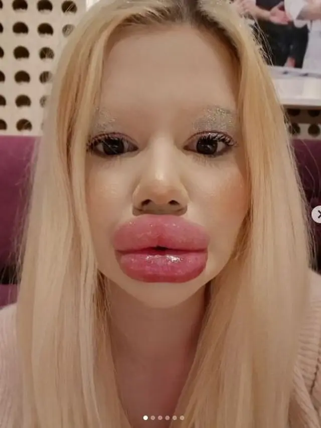 6 Foto Terkini Andrea Ivanova Wanita Viral Pemilik Bibir Terbesar, Kini ...