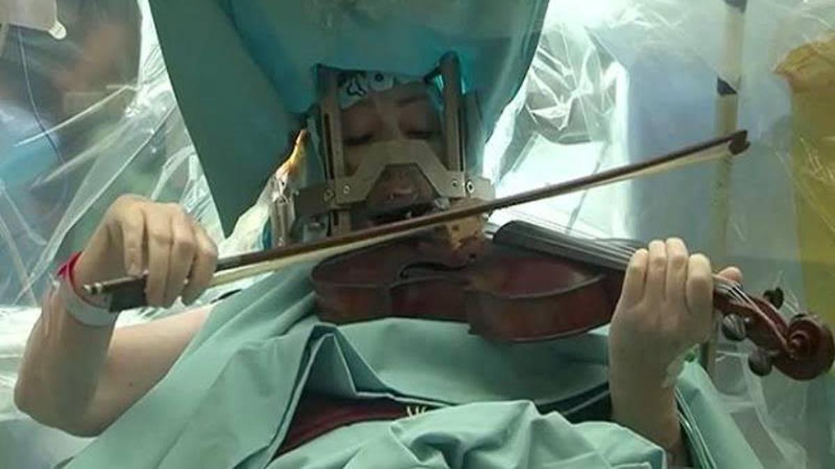 Jalani Operasi Otak, Dokter Suruh Pasiennya Main Biola - Citizen6 ...