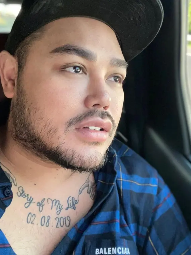 6 Potret Ivan Gunawan Usai Filler Bibir, Makin Cetar - Hot Liputan6.com