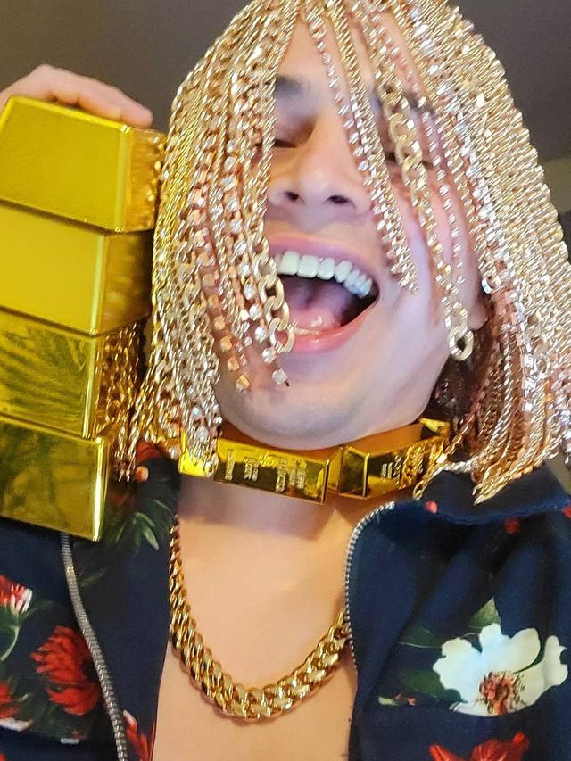Rapper Ini Pasang Implan Rantai Emas Sebagai Pengganti Rambut, Curi ...