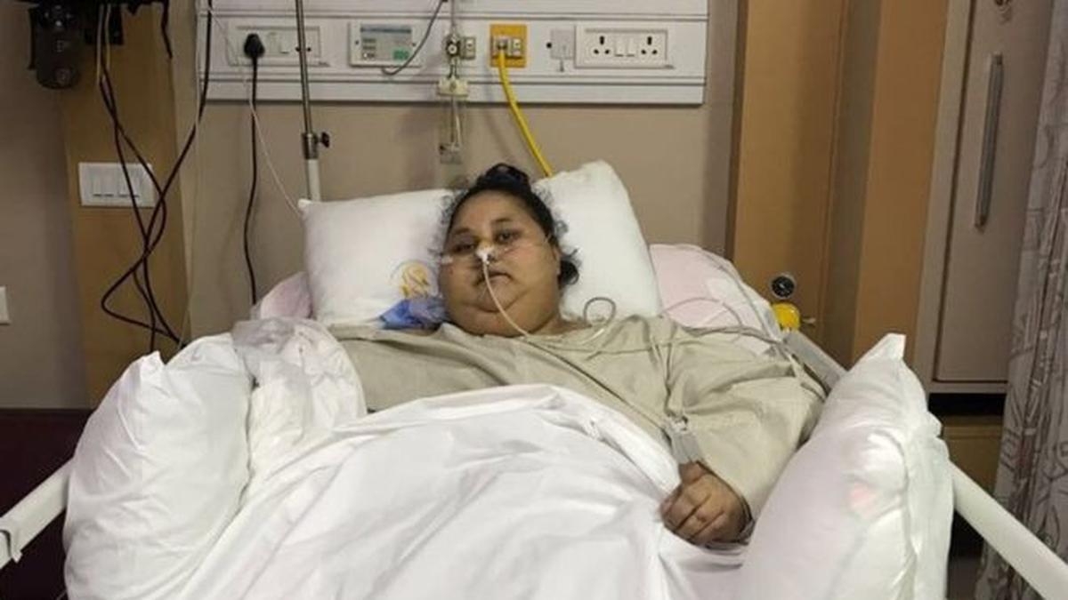 Pasca-Operasi, Bobot Perempuan Ini Susut 100 Kilogram