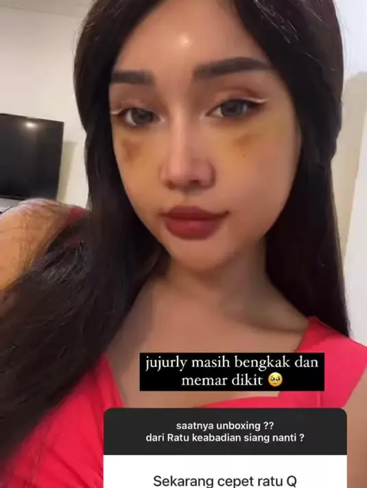 8 Potret Wajah Baru Lucinta Luna usai Operasi Plastik, Disebut Mirip Wonyoung IVE - Photo Fimela.com